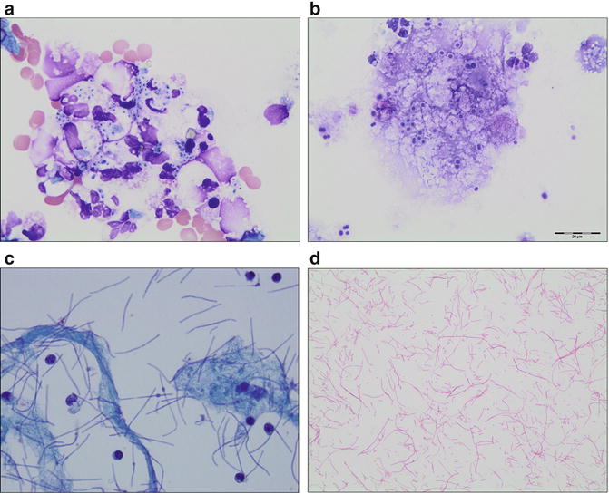 Artifacts, Contaminants, and Mimics in Cytology | SpringerLink