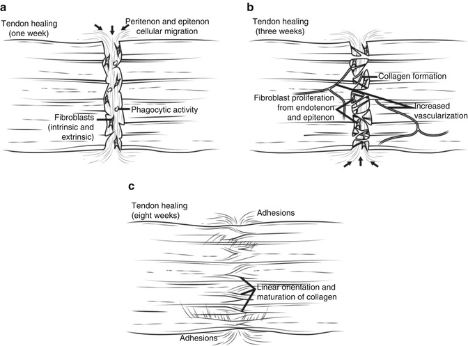 Tendon Healing | SpringerLink