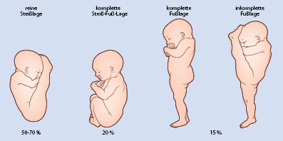 Geburtshilfliche Notfälle | SpringerLink