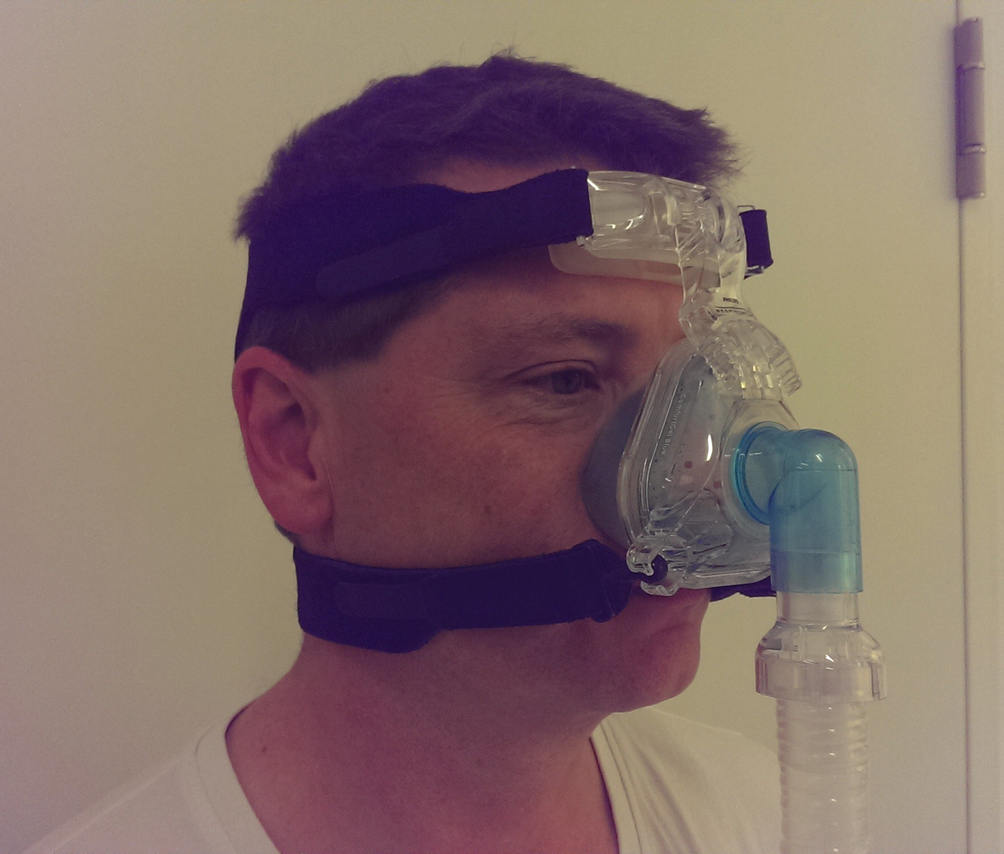 NIV – nichtinvasive Ventilation, nichtinvasive Beatmung | SpringerLink