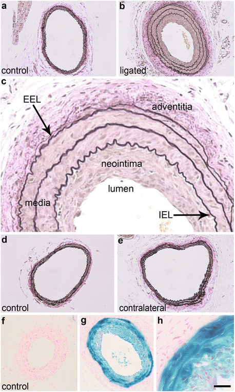 Ligation of the Mouse Common Carotid Artery | SpringerLink