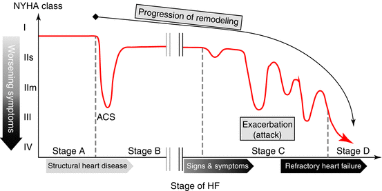 The Concept of Heart Failure: Chronic Diseases Accompanied by an Attack ...