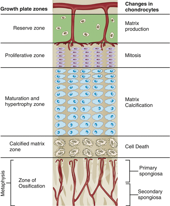 Rickets–Osteomalacia | SpringerLink