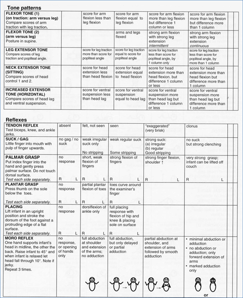 Neurological Examination of the Newborn Infant | SpringerLink