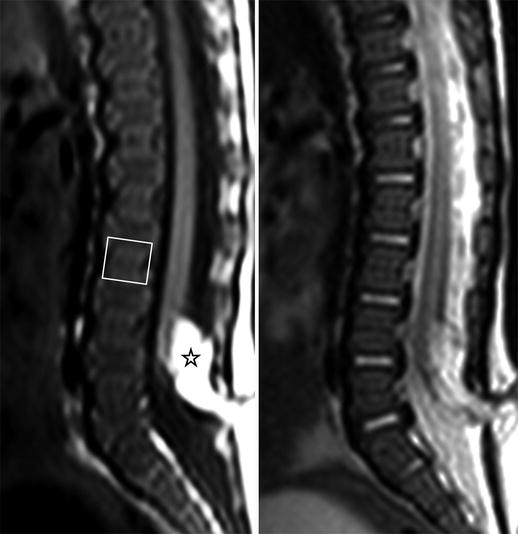 MRI of the Normal Bone Marrow: Anatomic Sites | SpringerLink