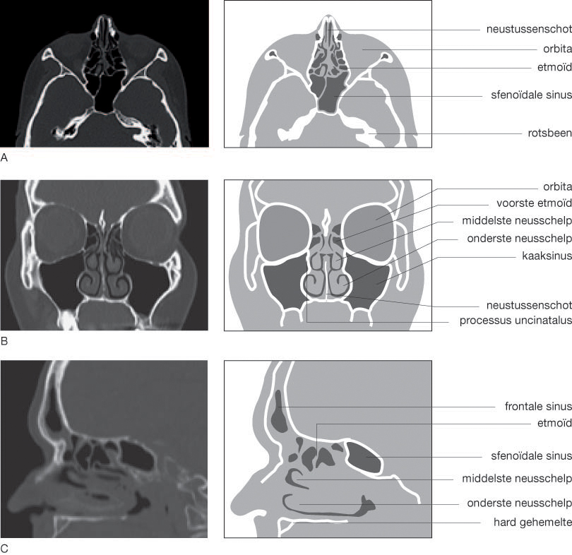 9 Anatomie en fysiologie van de neus | SpringerLink