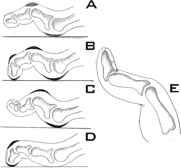 7 Afwijkende teen- en vissngerstanden | SpringerLink