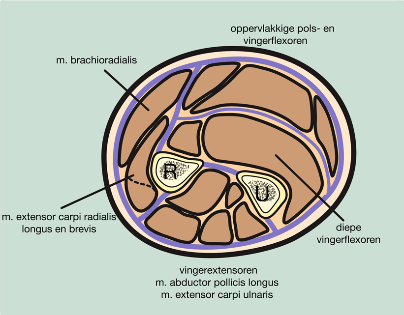 4a Addendum: het compartimentsyndroom van de onderarm | SpringerLink