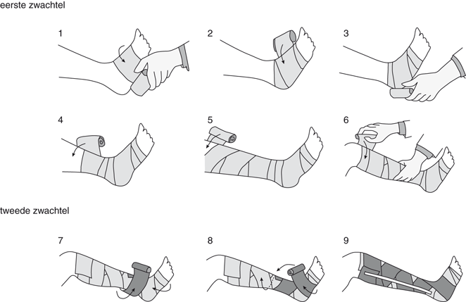 Ulcus cruris venosum | SpringerLink