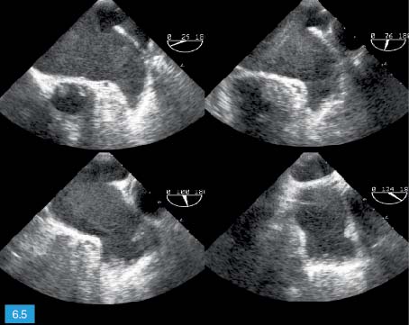 Linker en rechter atrium | SpringerLink