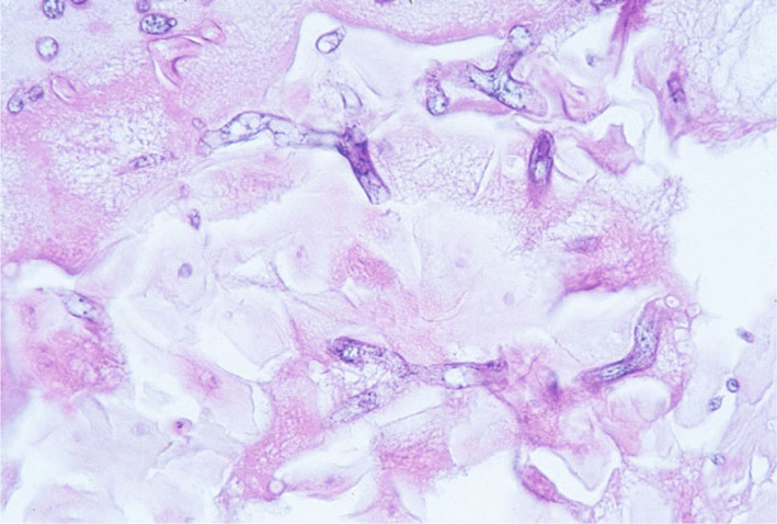 Het gehemelte | SpringerLink
