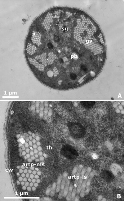 Microcystis | SpringerLink