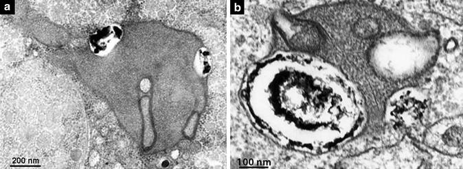 The Hydrogenosome | SpringerLink