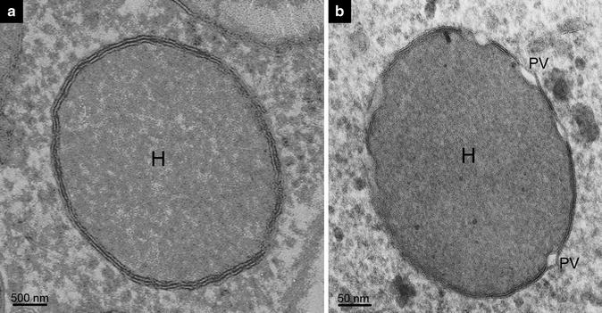 The Hydrogenosome | SpringerLink
