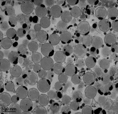The Hydrogenosome | SpringerLink