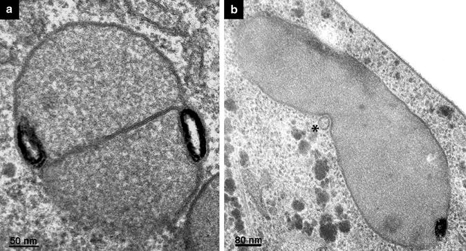 The Hydrogenosome | SpringerLink