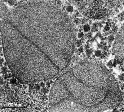 The Hydrogenosome | SpringerLink