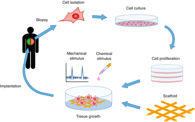 3D Bioprinting for Tissue Engineering | SpringerLink