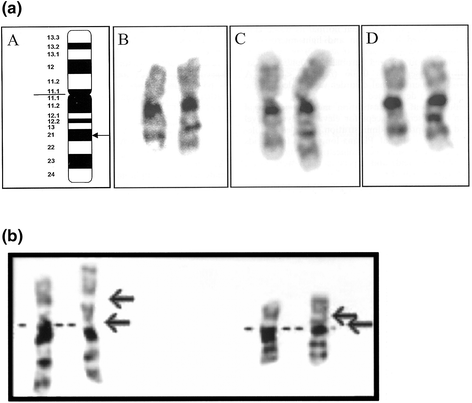 Chromosome Heteromorphism (Summaries) | SpringerLink