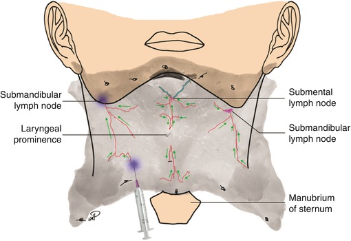 Lymphatic Anatomy and Clinical Implications | SpringerLink