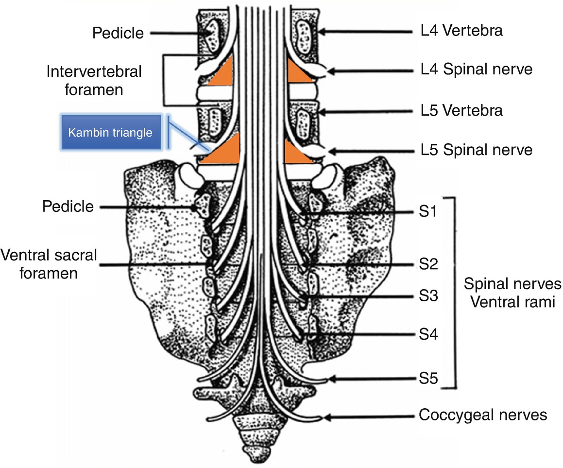 Percutaneous Full-Endoscopic Interlaminar Lumbar Spine Surgery ...