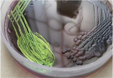 Biochemical and Molecular Characterization of Common UTI Pathogen ...