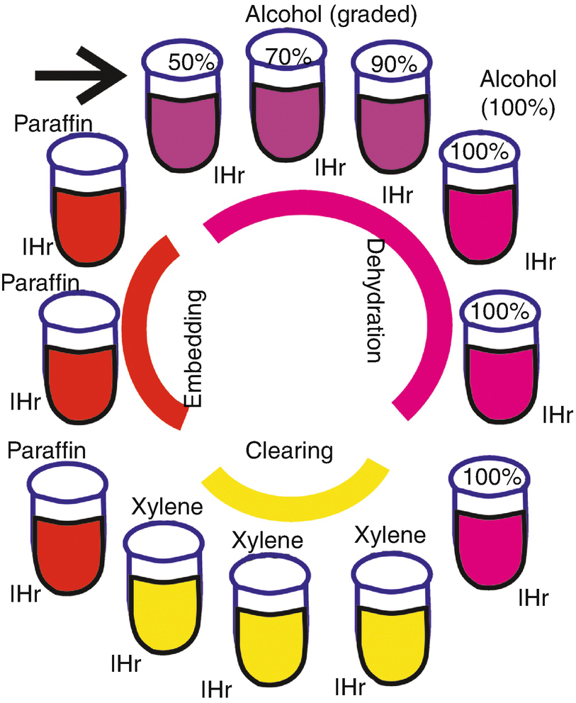 Processing of Tissue in Histopathology Laboratory | SpringerLink