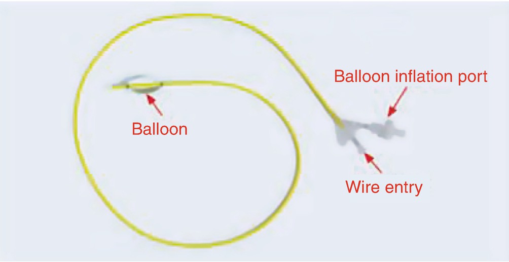 Balloon Dilatation Catheter | SpringerLink