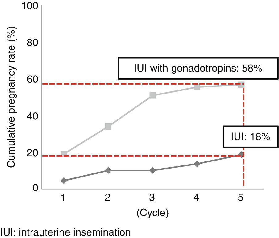 Unexplained Infertility: Treatment Strategy for Unexplained Infertility ...
