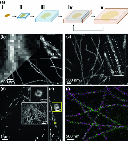 Expansion Microscopy for Brain Imaging | SpringerLink
