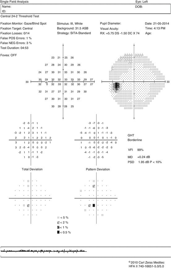 The Visual Field | SpringerLink