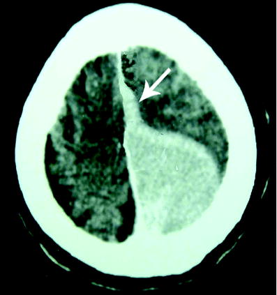Tumours and Infections (☞ SOL) | SpringerLink