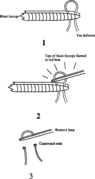 Vasectomizing a Mouse | SpringerLink