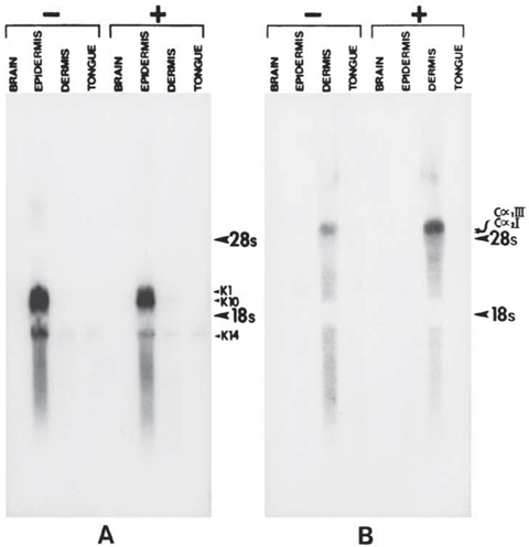 Separation of Epidermal Tissue from Underlying Dermis and Primary ...