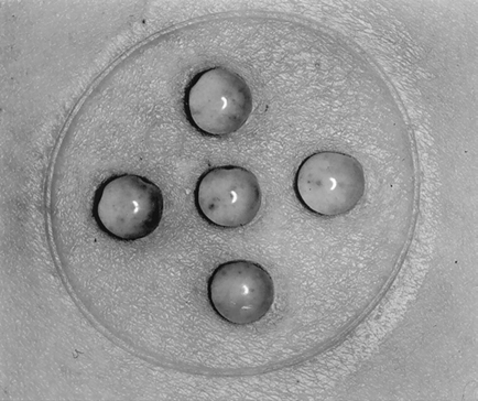 Suction Blister Model of Wound Healing | SpringerLink