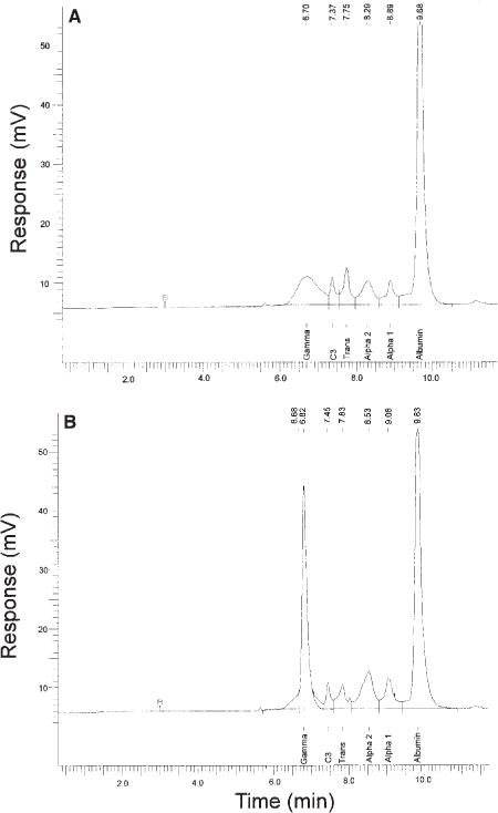 Serum Protein Electrophoresis | SpringerLink