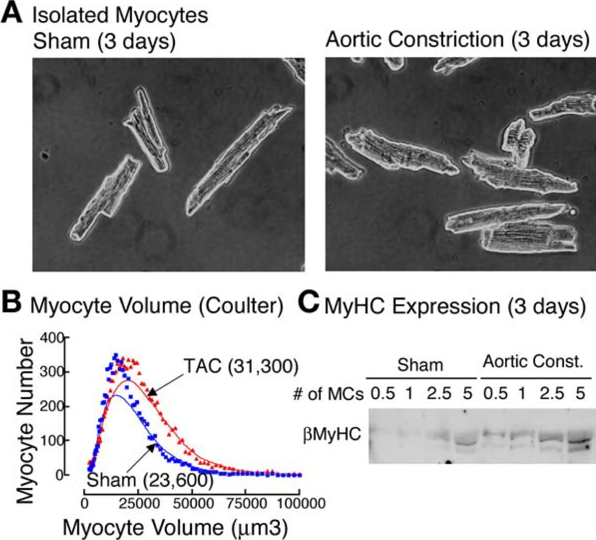 Isolation and Culture of Adult Mouse Cardiac Myocytes | SpringerLink