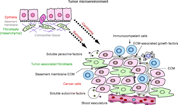 Desmoplasia | SpringerLink