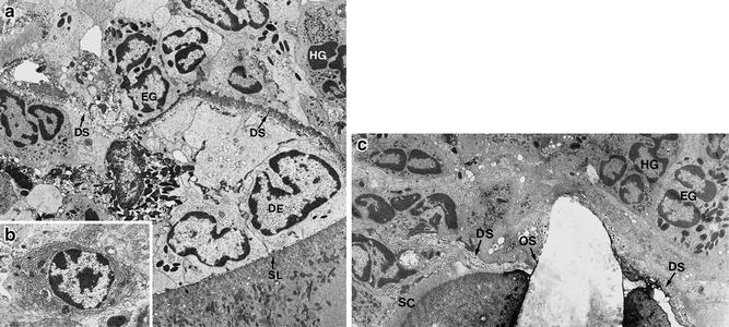 Acanthocephalan Infections | SpringerLink