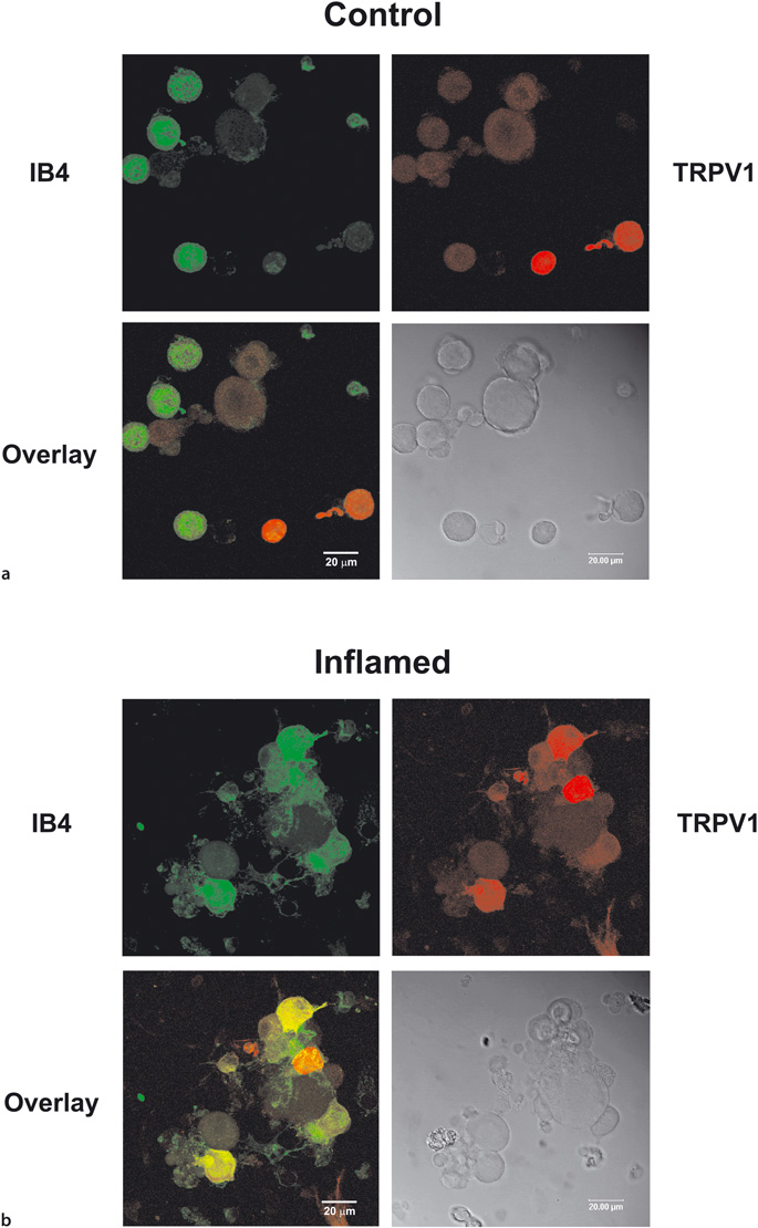 IB4-Positive Neurons, Role in Inflammatory Pain | SpringerLink
