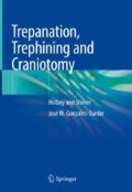 Greco-Roman Surgical Instruments for Trepanation | SpringerLink