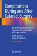 Small Incision Cataract Surgery (SICS = Modified ECCE) | SpringerLink