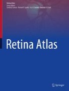 Retina Atlas | Book series home