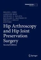 Surgical Technique: Arthroscopic Femoral Osteochondroplasty Using T ...