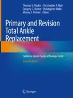INFINITY® Total Ankle Replacement Including PROPHECY® Patient-Specific ...