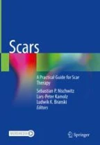 Pathophysiology of Burn Wounds | Springer Nature Link