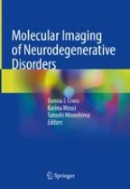 FDG PET Imaging Evaluation of Neurodegenerative Dementias | Springer ...