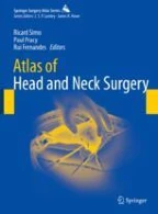 Radical and Modified Radical Neck Dissection | Springer Nature Link