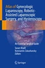 Hysteroscopy | Springer Nature Link