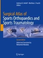 Chondral and Osteochondral Lesions of the Shoulder Joint | Springer ...